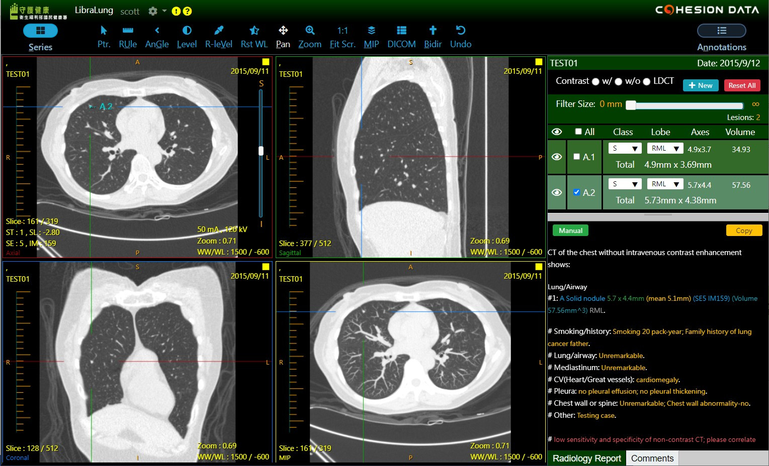 Medical Imaging Aided Disease Detection System - Solutions - Cohesion ...